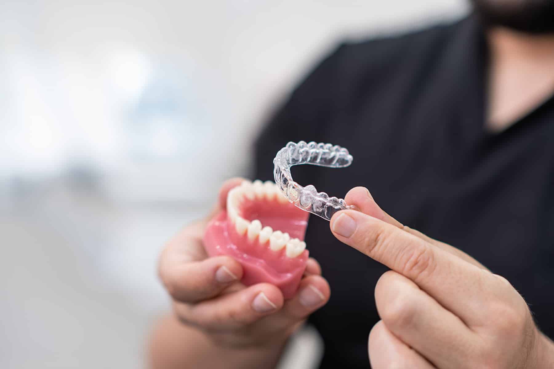 Who Can Benefit from Clear Aligners? - Serenity Dental